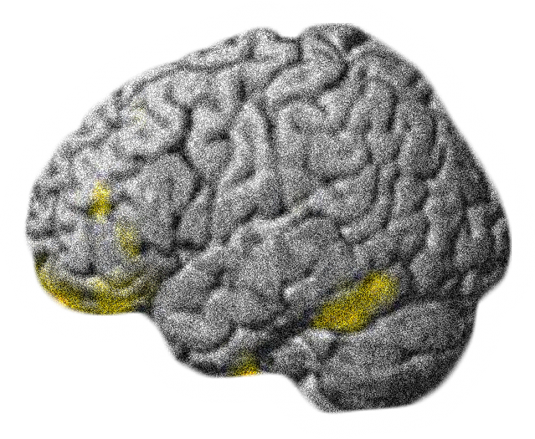 Hypoactive Sexual Desire Disorder - Right To Desire